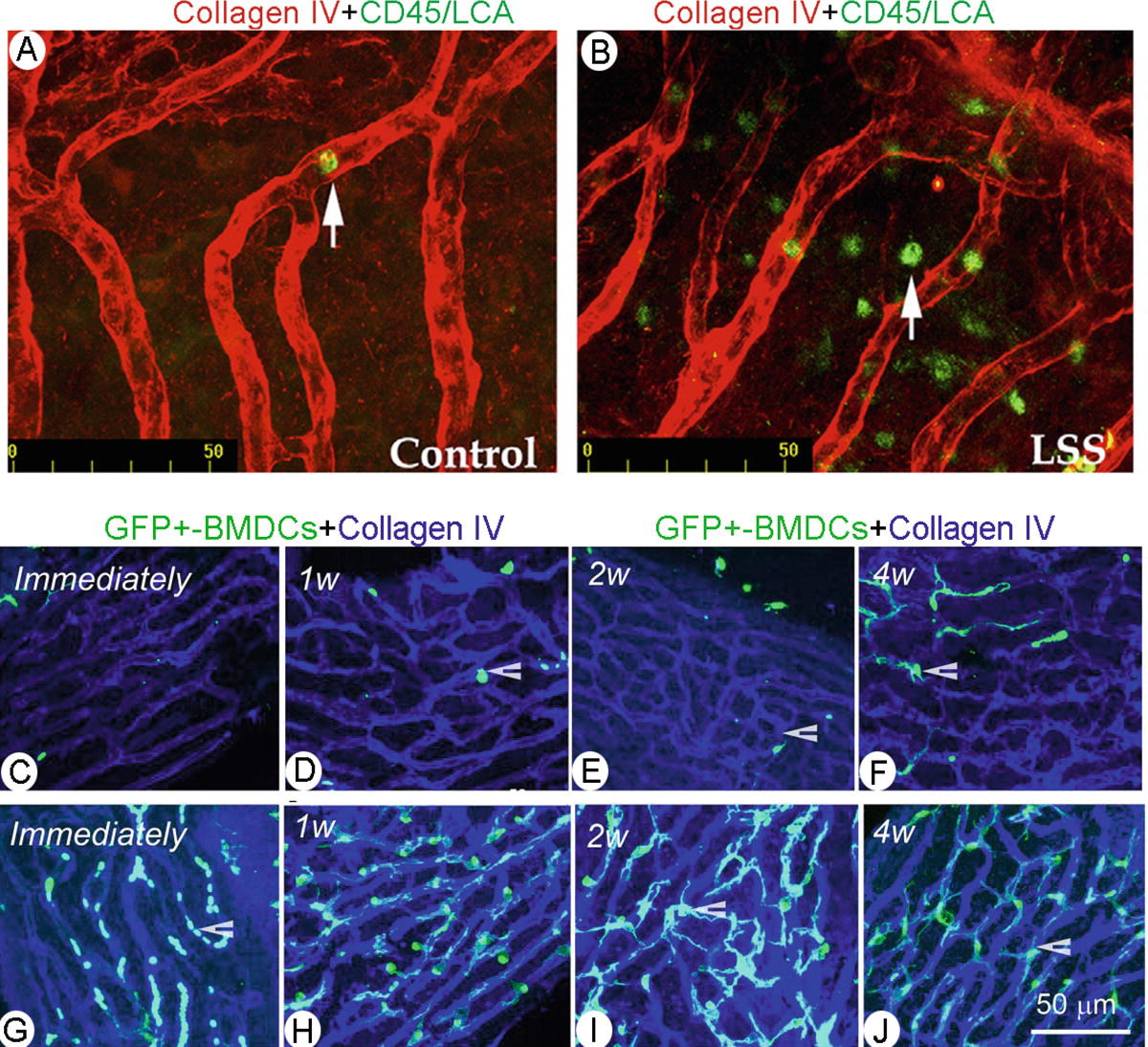 Cochlear Vascular Pathology and Hearing Loss | SpringerLink