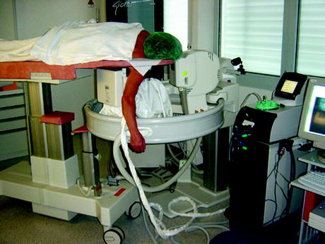 Available Stereotactic Systems for Breast Biopsy | SpringerLink