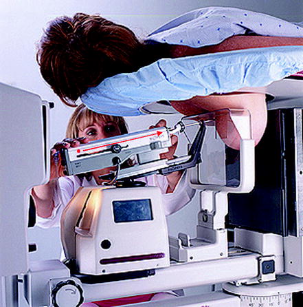 Available Stereotactic Systems for Breast Biopsy | SpringerLink