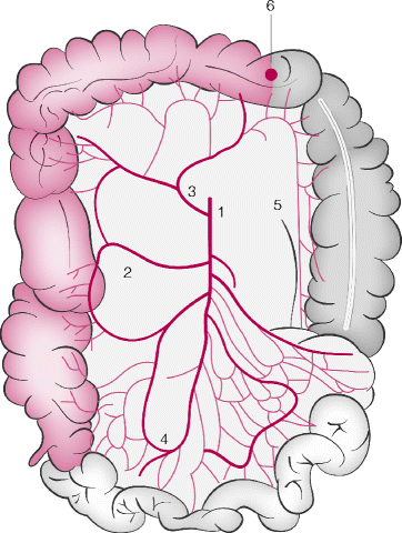 Right Hemicolectomy and Appendix | SpringerLink