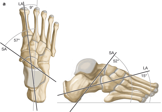 Ligamente: Rupturen und Luxationen | SpringerLink