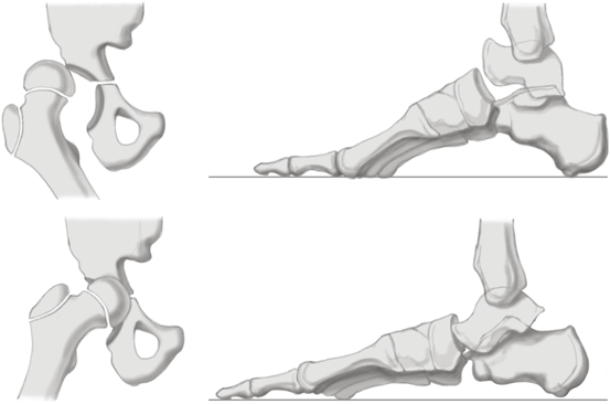 Ligamente: Rupturen und Luxationen | SpringerLink