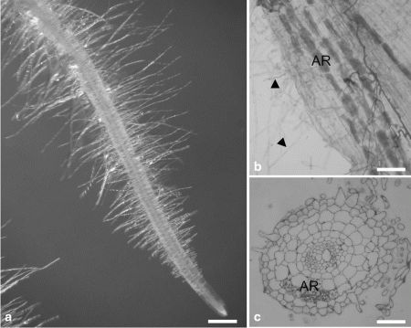 Root Hair Colonization by Mycorrhizal Fungi | SpringerLink