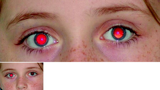 The Brückner Test Revisited | SpringerLink