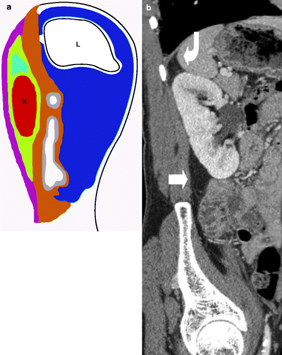 Normal Radiological Anatomy of the Retroperitoneum | SpringerLink