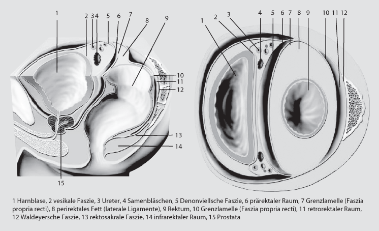 Rektumkarzinom | SpringerLink