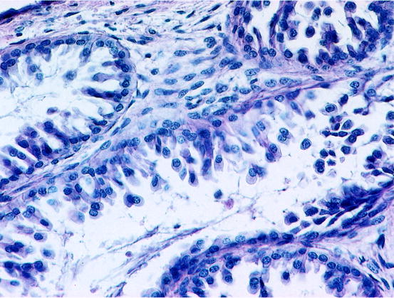 Metaplastic Changes | SpringerLink
