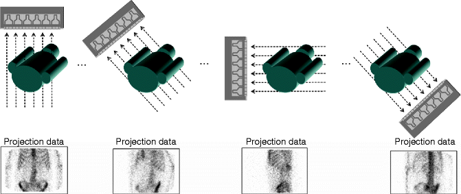 Basic Principles of SPECT and PET Imaging | SpringerLink