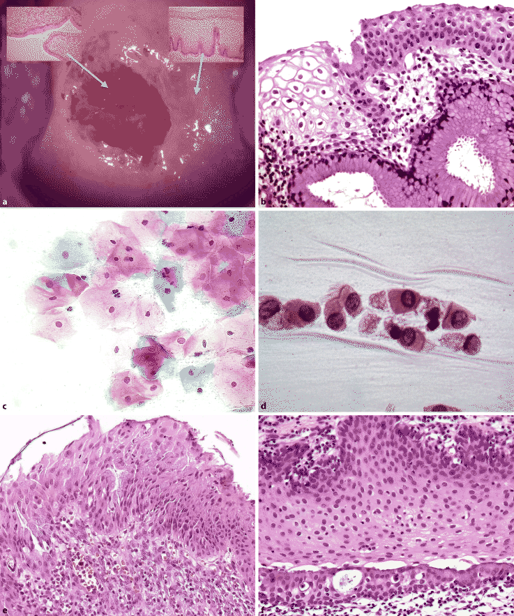 Zervix | SpringerLink