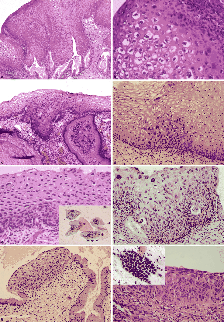 Zervix | SpringerLink