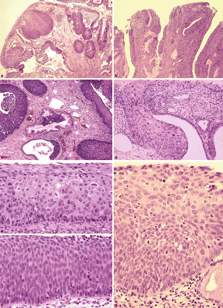 Zervix | SpringerLink