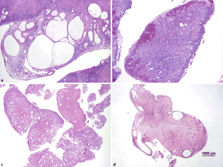 Erkrankungen des Endometriums | SpringerLink