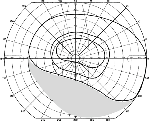 Netzhaut | SpringerLink
