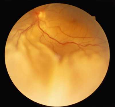 Netzhaut | SpringerLink