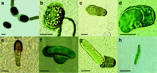 Akinetes: Dormant Cells of Cyanobacteria | SpringerLink