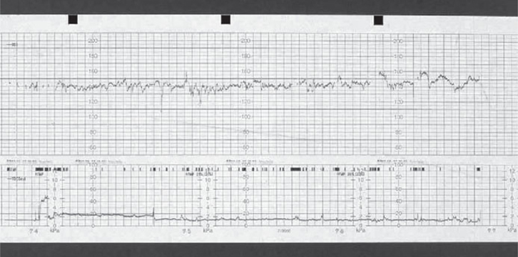 Schwangerenvorsorge | SpringerLink
