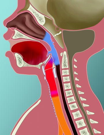 Clinical Evaluation of Airway Obstruction | SpringerLink