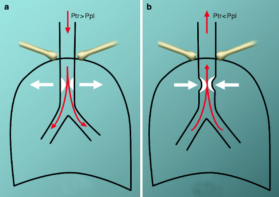 Clinical Evaluation of Airway Obstruction | SpringerLink