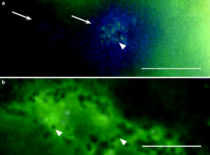 The Morphology of Varicella-Zoster Virus Epithelial Keratitis in Herpes ...
