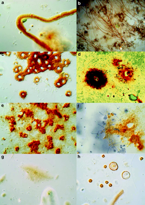 Neutrophilic Iron-Depositing Microorganisms | SpringerLink