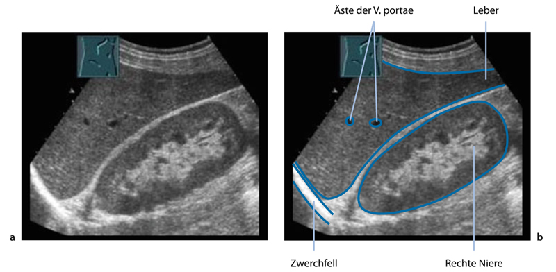 Abdomen | SpringerLink