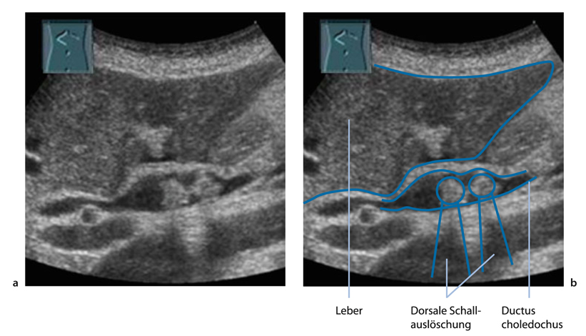 Abdomen | SpringerLink
