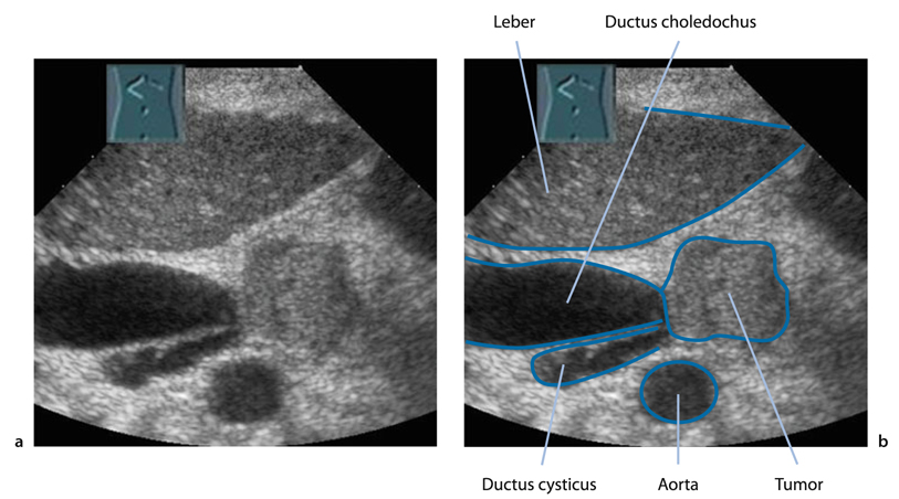 Abdomen | SpringerLink