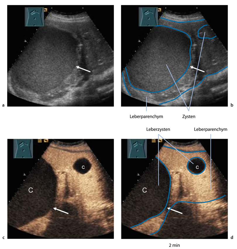Abdomen | SpringerLink