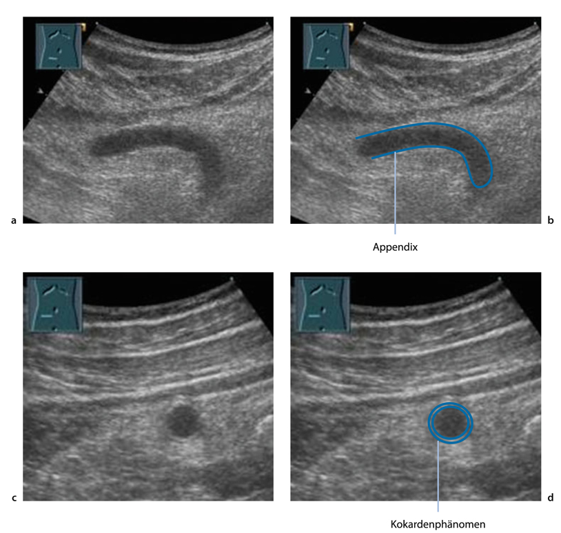 Abdomen | SpringerLink