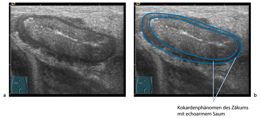 Abdomen | SpringerLink