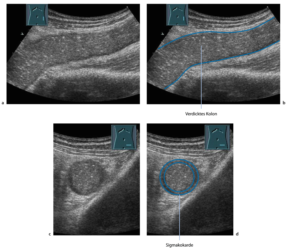 Abdomen | SpringerLink