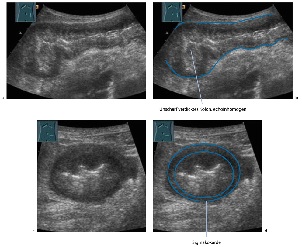Abdomen | SpringerLink