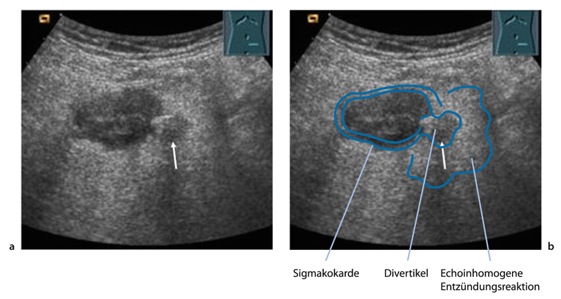 Abdomen | SpringerLink