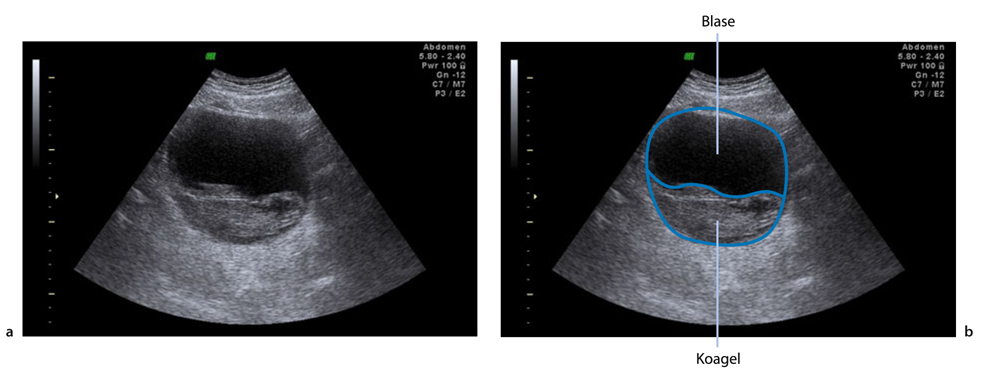 Fehlbefundung und deren Vermeidung | SpringerLink