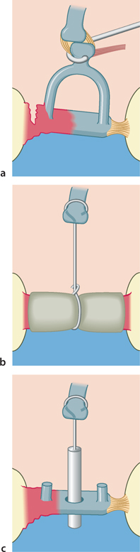 Klinik des Mittelohres | SpringerLink