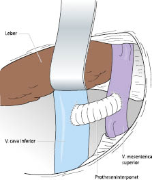 Pfortadersystem | SpringerLink
