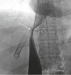 Pfortadersystem | SpringerLink