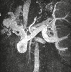 Pfortadersystem | SpringerLink