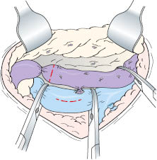 Pfortadersystem | SpringerLink