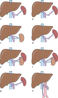 Pfortadersystem | SpringerLink