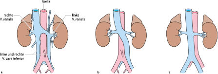 V. cava inferior | SpringerLink