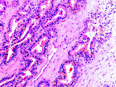 Anatomy and Normal Histology of the Prostate Pertinent to Biopsy ...