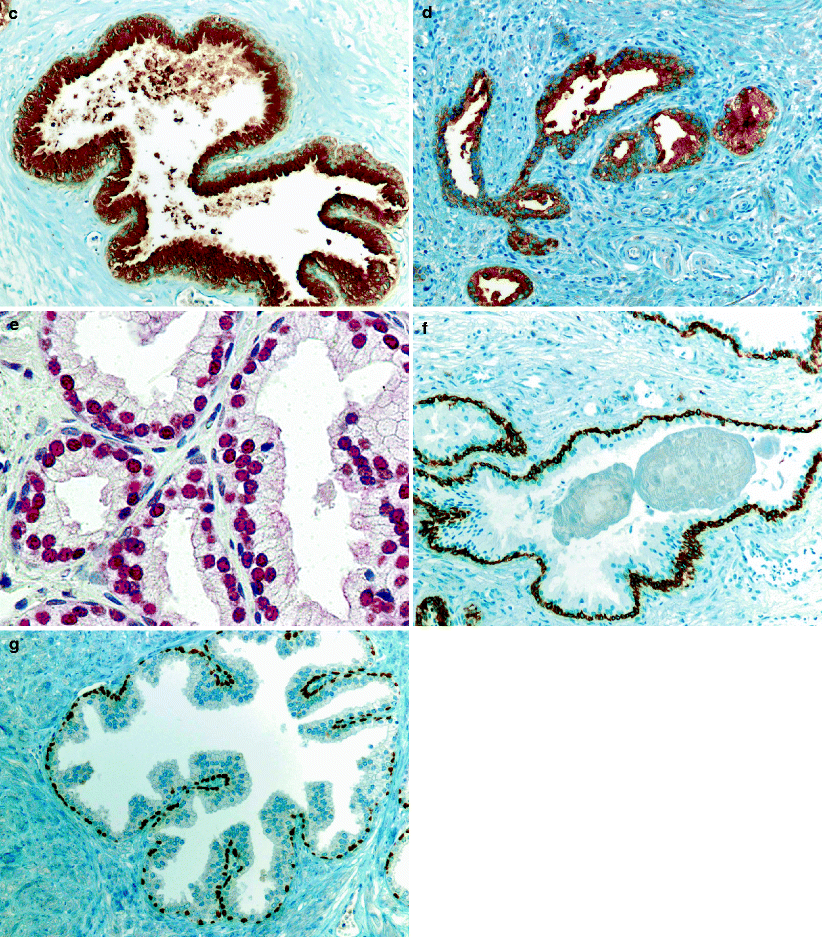 Anatomy and Normal Histology of the Prostate Pertinent to Biopsy ...