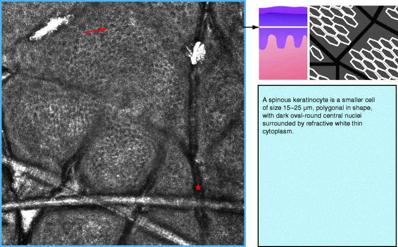 Epidermis, Dermis and Epidermal Appendages | SpringerLink