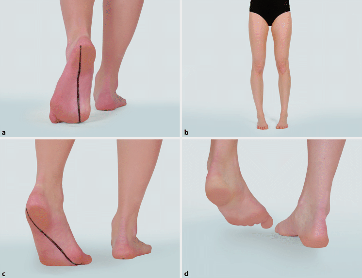 Spurbreite | SpringerLink