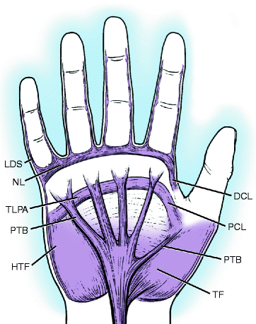 Dupuytren’s Disease: Anatomy, Pathology, and Presentation | SpringerLink