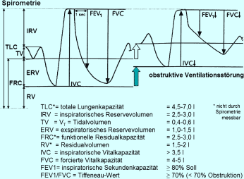 Respiratorische Insuffizienz und Beatmung | SpringerLink