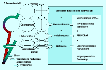 Respiratorische Insuffizienz und Beatmung | SpringerLink