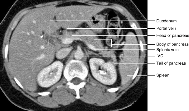 Pancreas and Spleen | SpringerLink