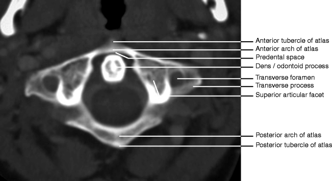 Vertebral Column | SpringerLink